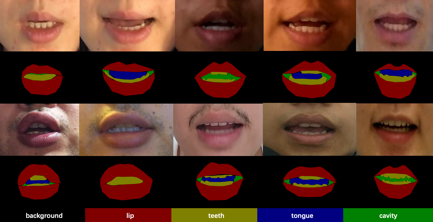 Fine Grained Lip Image Segmentation Using Fuzzy Logic And Graph Reasoning Yangleisx